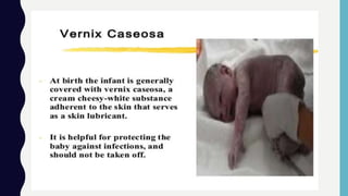 Normal Neonates | PPTX | Pregnancy | Reproductive Health