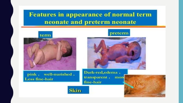 Normal Neonates | PPTX | Pregnancy | Reproductive Health