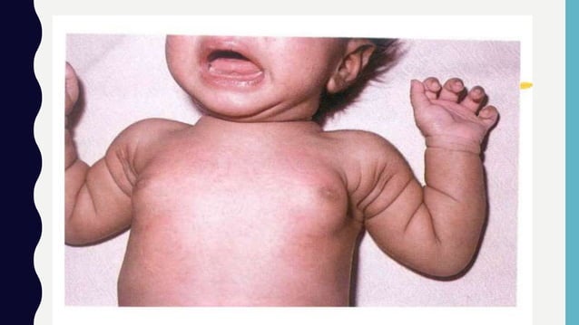 Normal Neonates | PPTX | Pregnancy | Reproductive Health