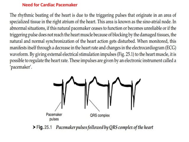 Unit 6 pacemaker PPT ALL PACE MAKER INTRODUCTION IN THE PPT | PPTX