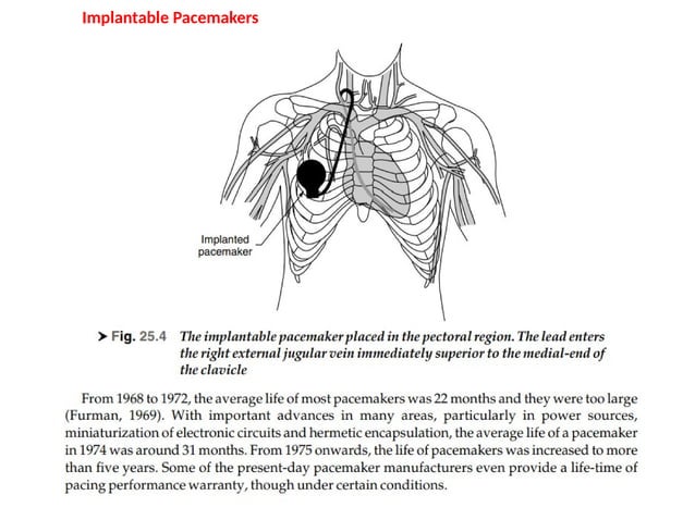 Unit 6 pacemaker PPT ALL PACE MAKER INTRODUCTION IN THE PPT | PPTX