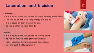 UNIT - 8 Sports Injury | PPT