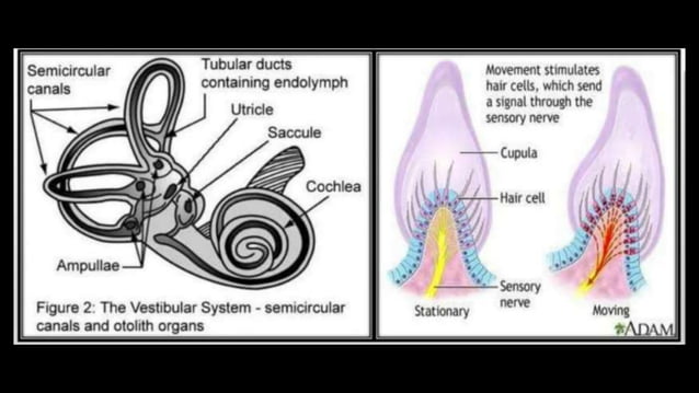VESTIBULAR SYSTEM MASLP | PPTX | Brain and Nervous System Disorders ...