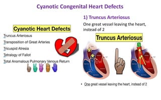 Unite 3 Congenital Heart Diseases-5.pptx