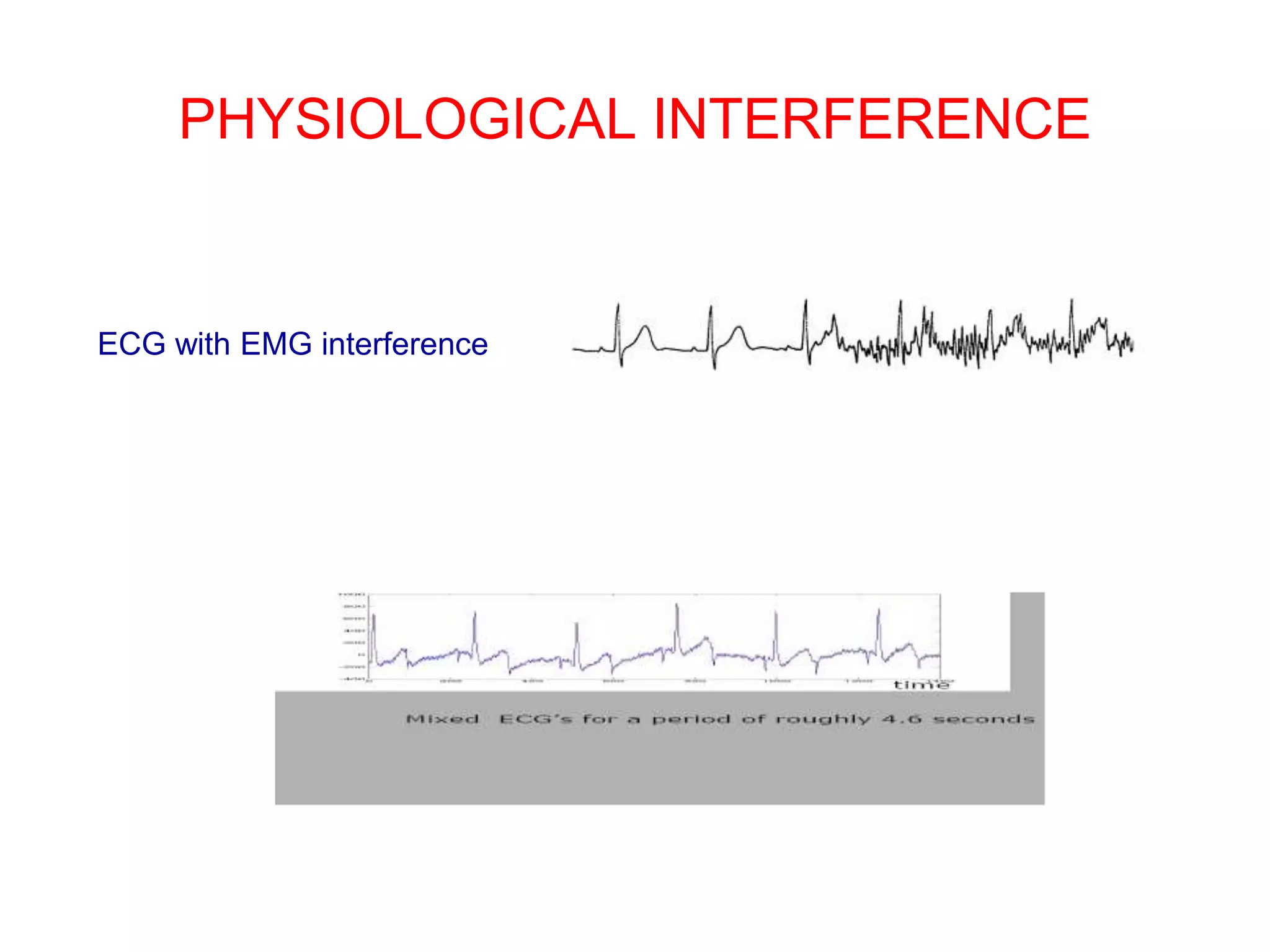 Biomedical Signals | PPT