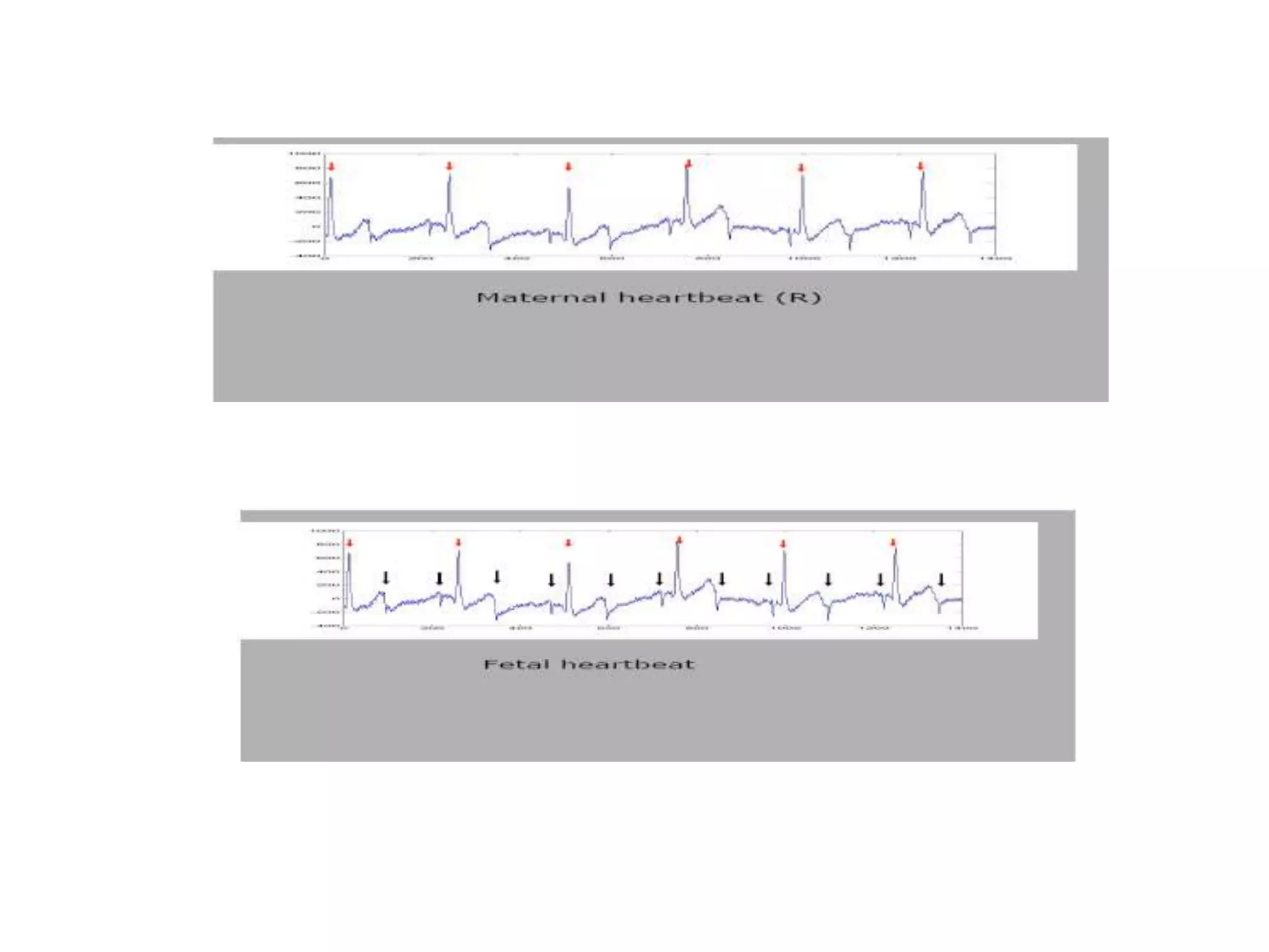 Biomedical Signals | PPT