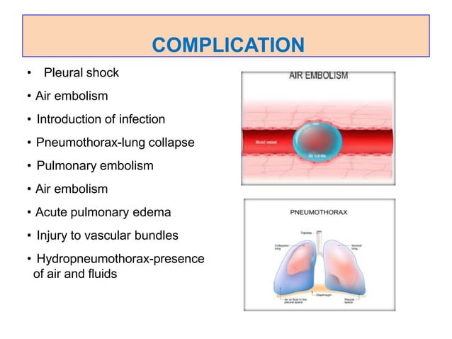 Unit III 3. Pleural Effusion.ppt | Lung and Respiratory Health ...