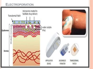 Unit iii transdermal drug delivery system | PPTX