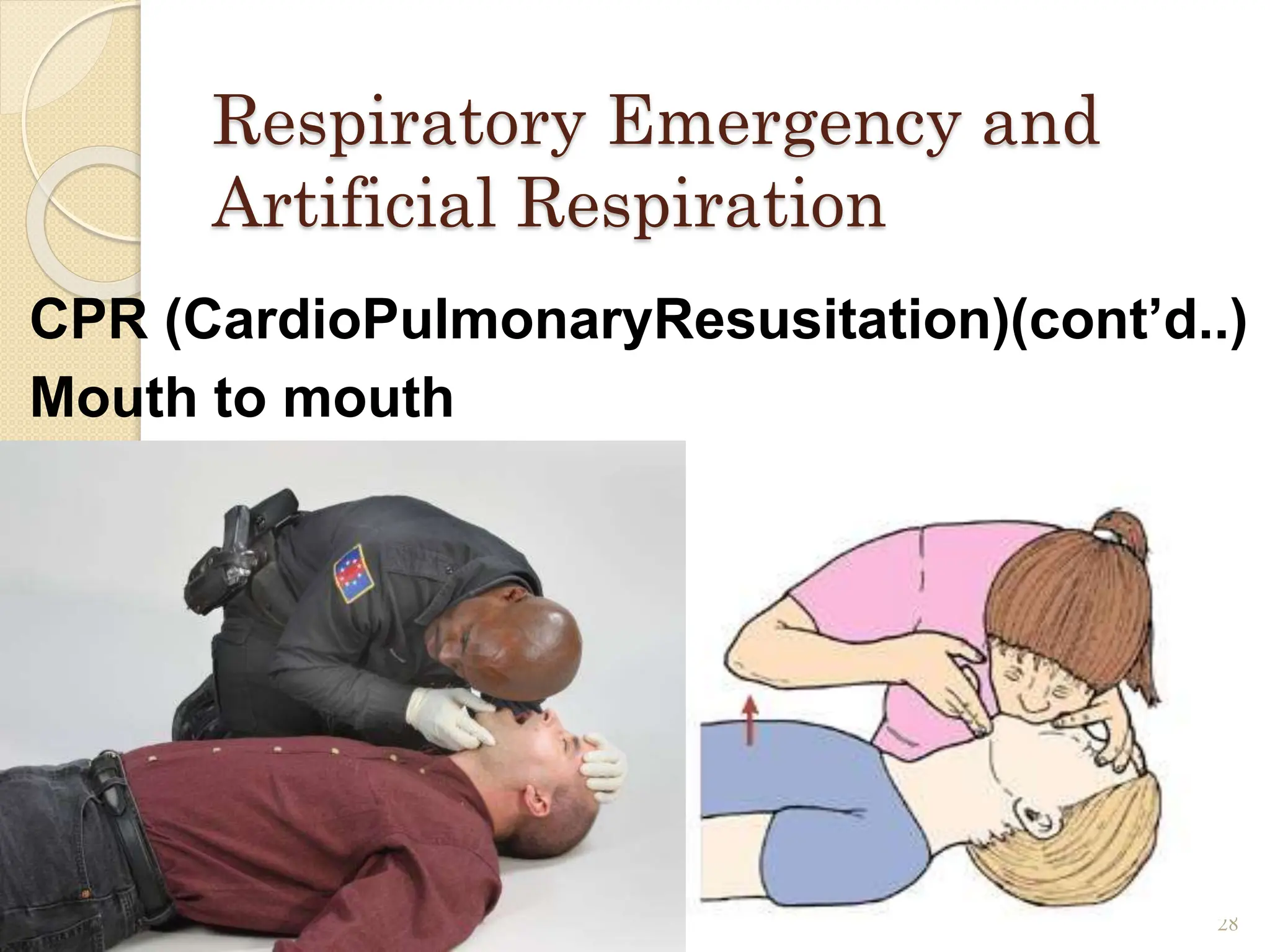 Unit II Respiratory Emergency.pptx respiration | PPTX