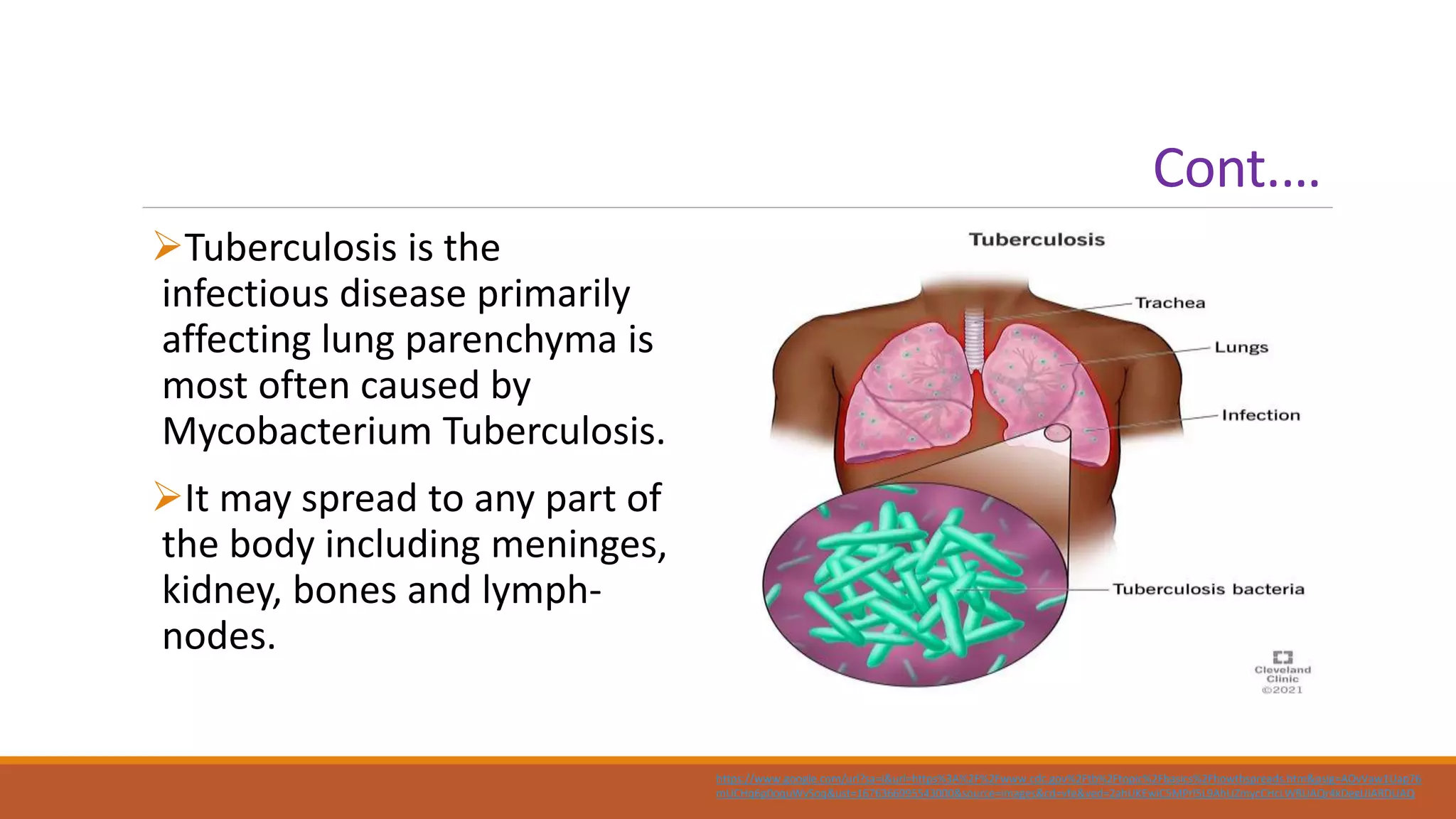 UNIT I Lecture I Disorders spread by droplet infections.pptx