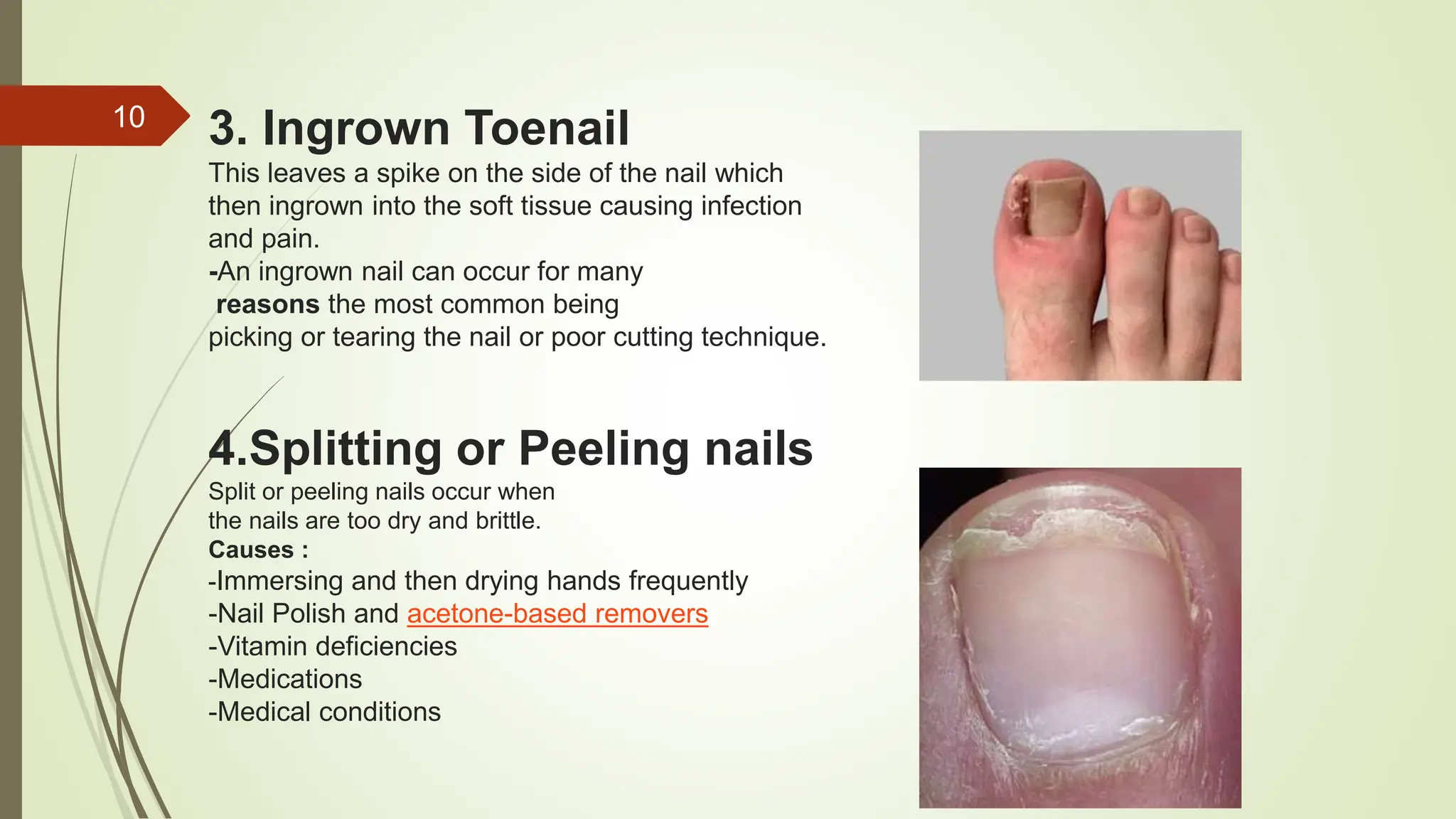 Unit IV Assessment of nail.pptx