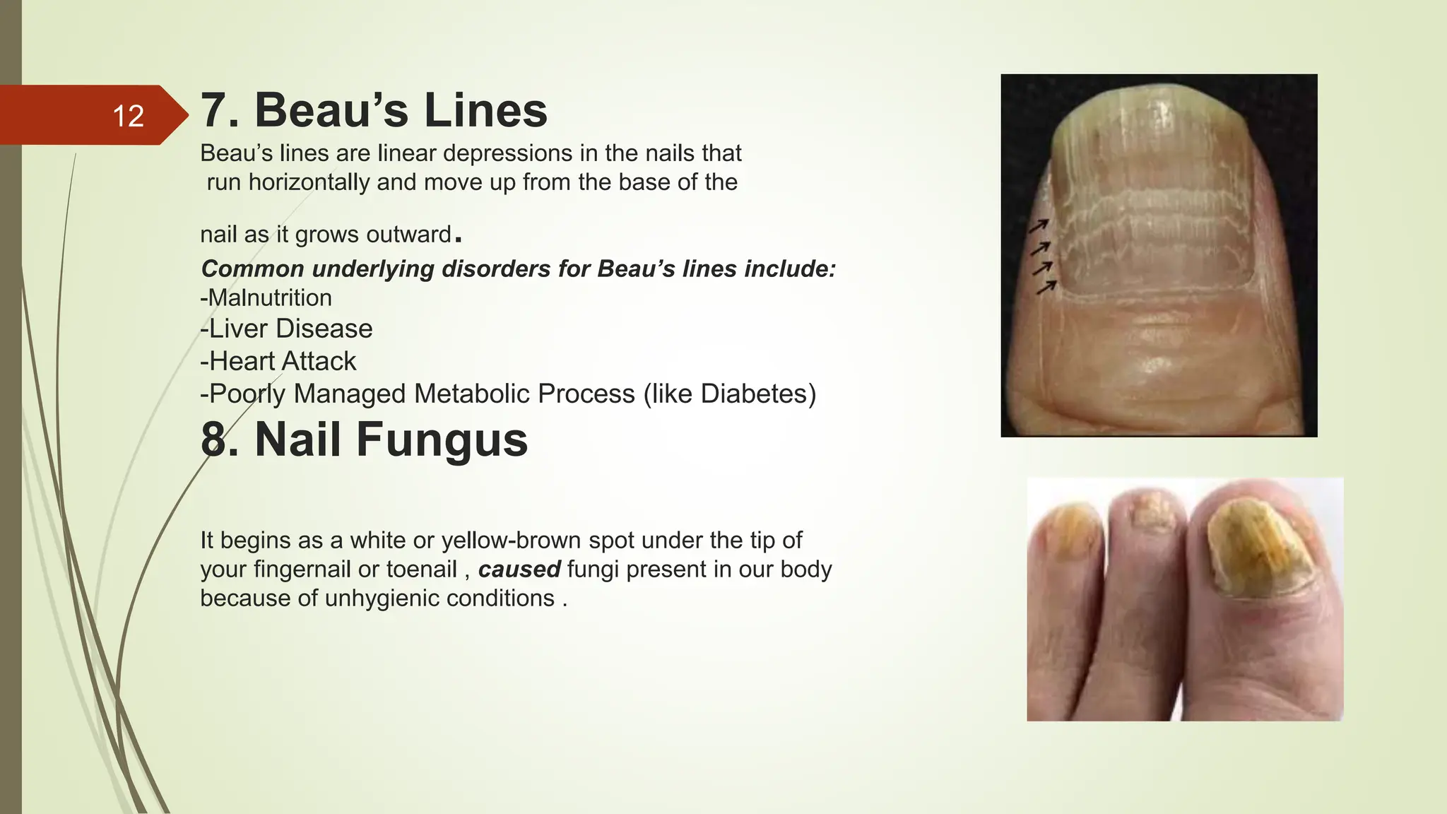 Unit IV Assessment of nail.pptx