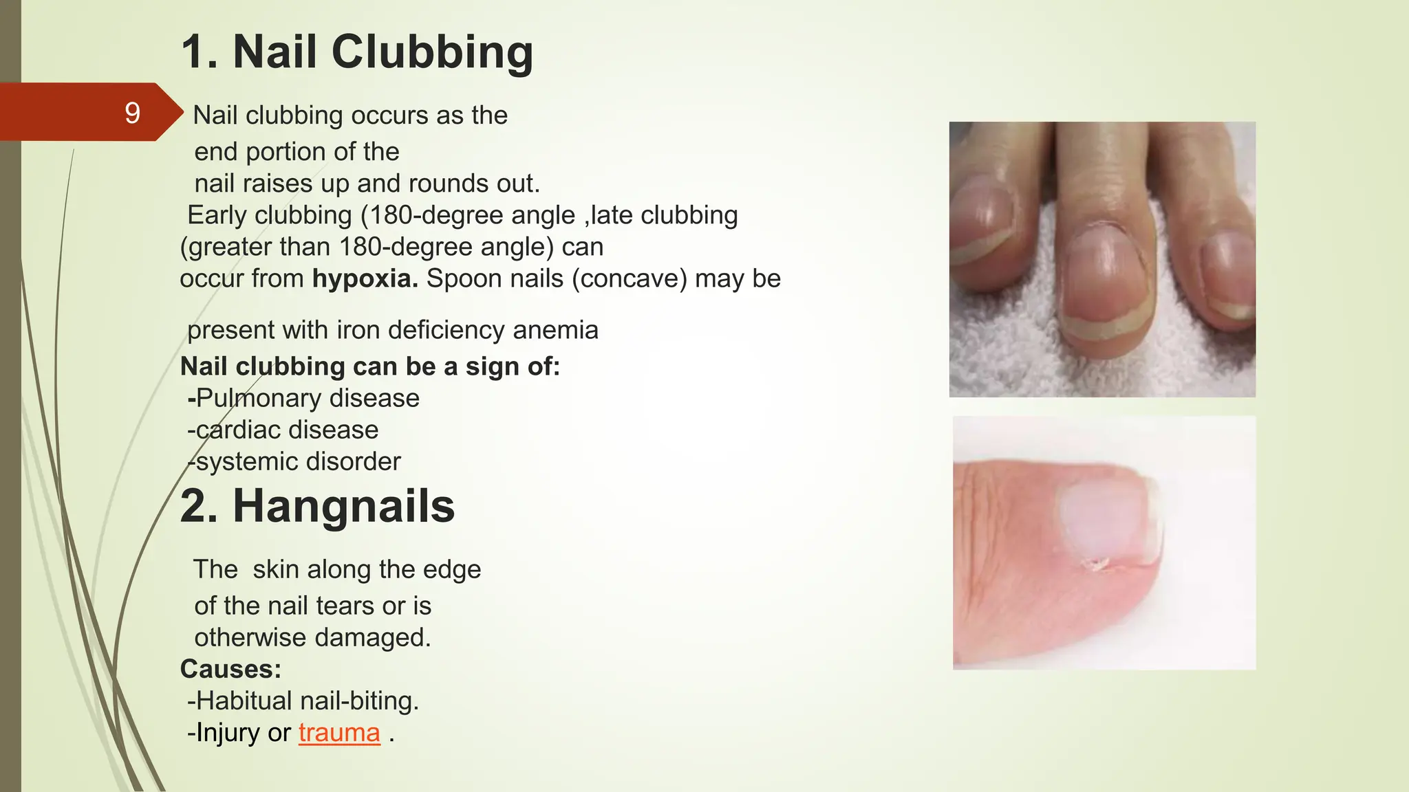 Unit IV Assessment of nail.pptx