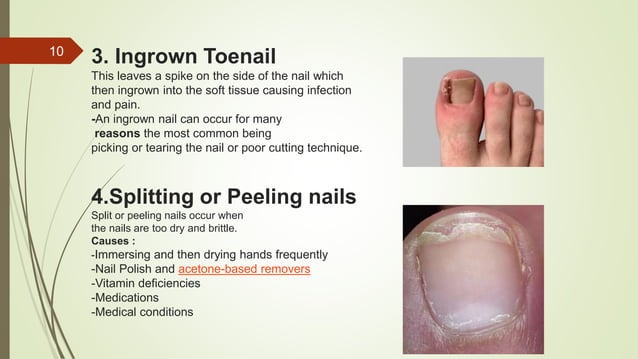 Unit IV Assessment of nail.pptx