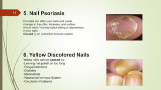 Unit IV Assessment of nail.pptx
