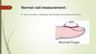 Unit IV Assessment of nail.pptx