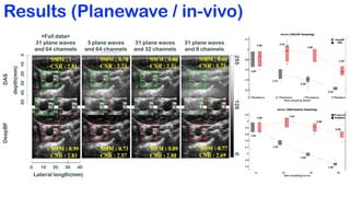 Universal plane wave compounding for high quality us imaging using deep ...