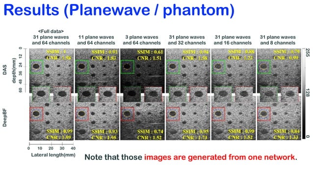 Universal plane wave compounding for high quality us imaging using deep ...