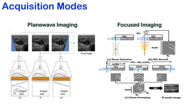Universal plane wave compounding for high quality us imaging using deep ...
