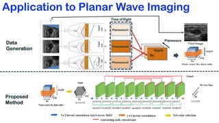 Universal plane wave compounding for high quality us imaging using deep ...