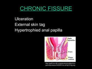 Rectum and anus diseases | PPT