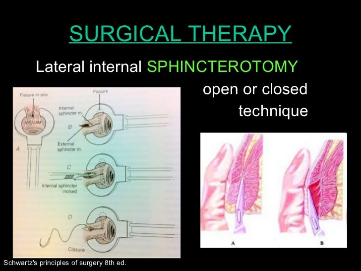Rectum and anus diseases