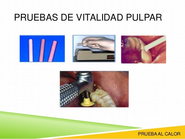 pasos para la correcta planificación de diagnóstico en Endodoncia