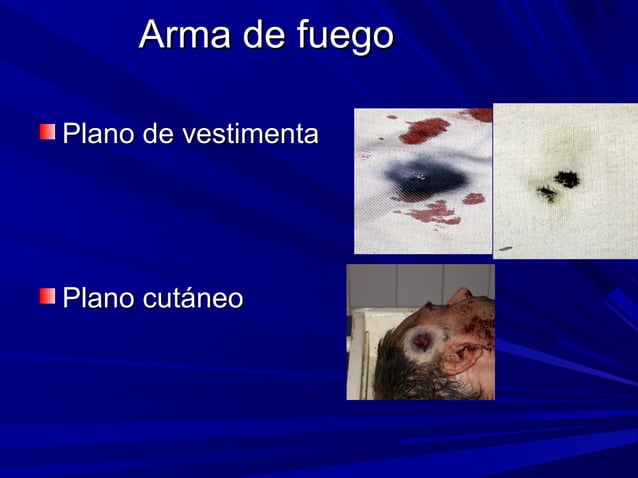Protocolos - Tanatología - Lesiones Patología Forense | PPT