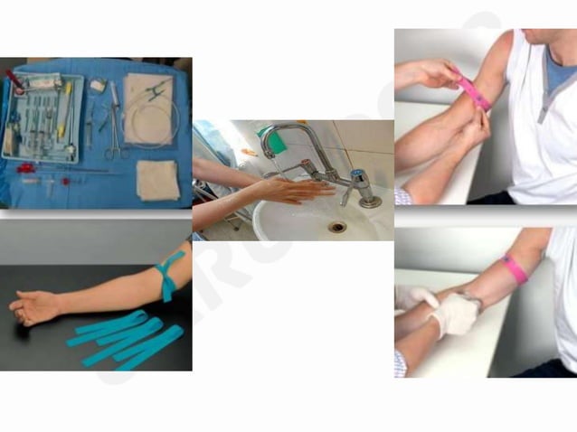 Unknown facts about iv cannulation | PPT