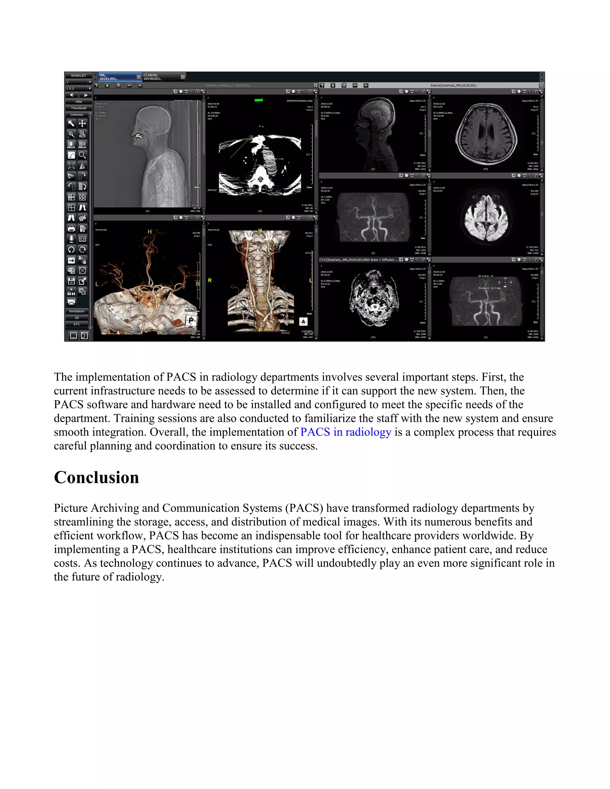 Unlocking Efficiency How PACS in Radiology Are Saving Time and ...