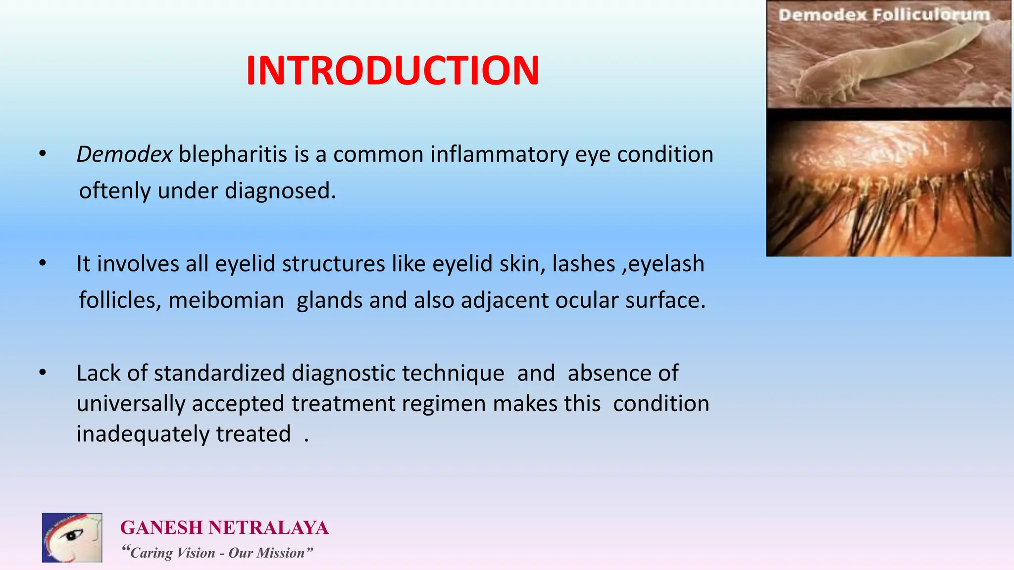 UNMET NEEDS IN THE MANAGEMENT OF DEMODEX BLEPHARITIS.pptx