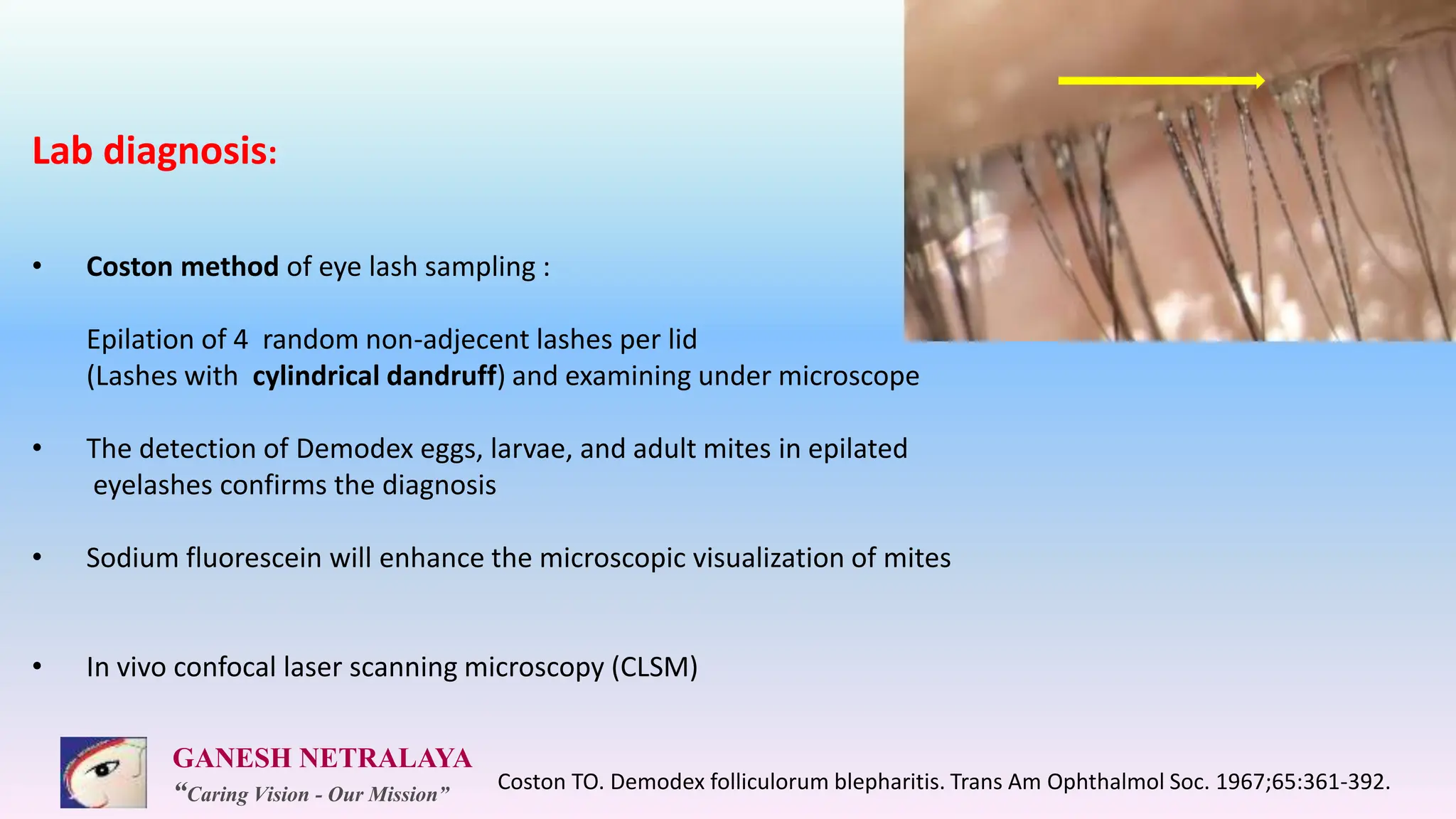 UNMET NEEDS IN THE MANAGEMENT OF DEMODEX BLEPHARITIS.pptx