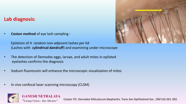 UNMET NEEDS IN THE MANAGEMENT OF DEMODEX BLEPHARITIS.pptx
