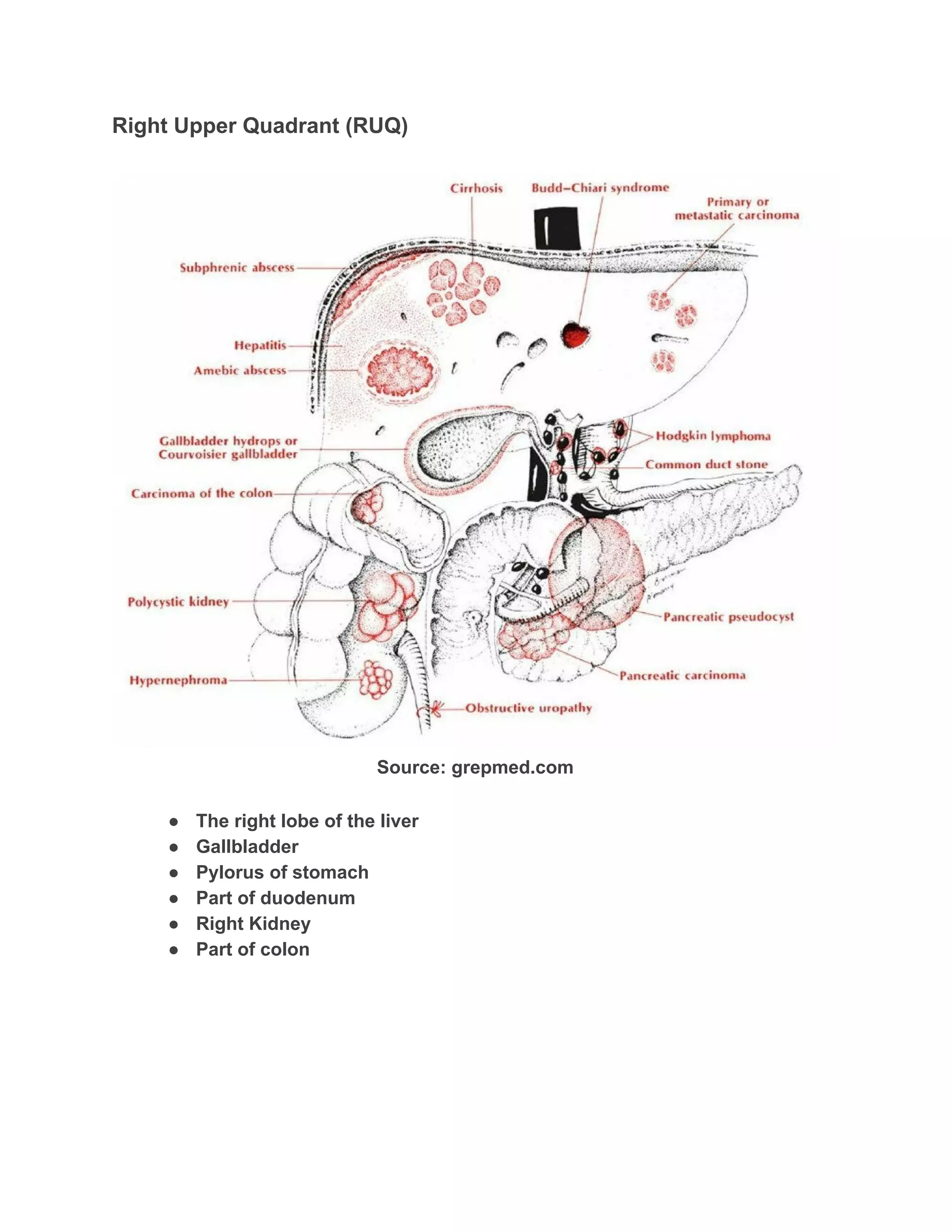 Unravel the mystery of right upper quadrant (ruq) abdominal pain | PDF