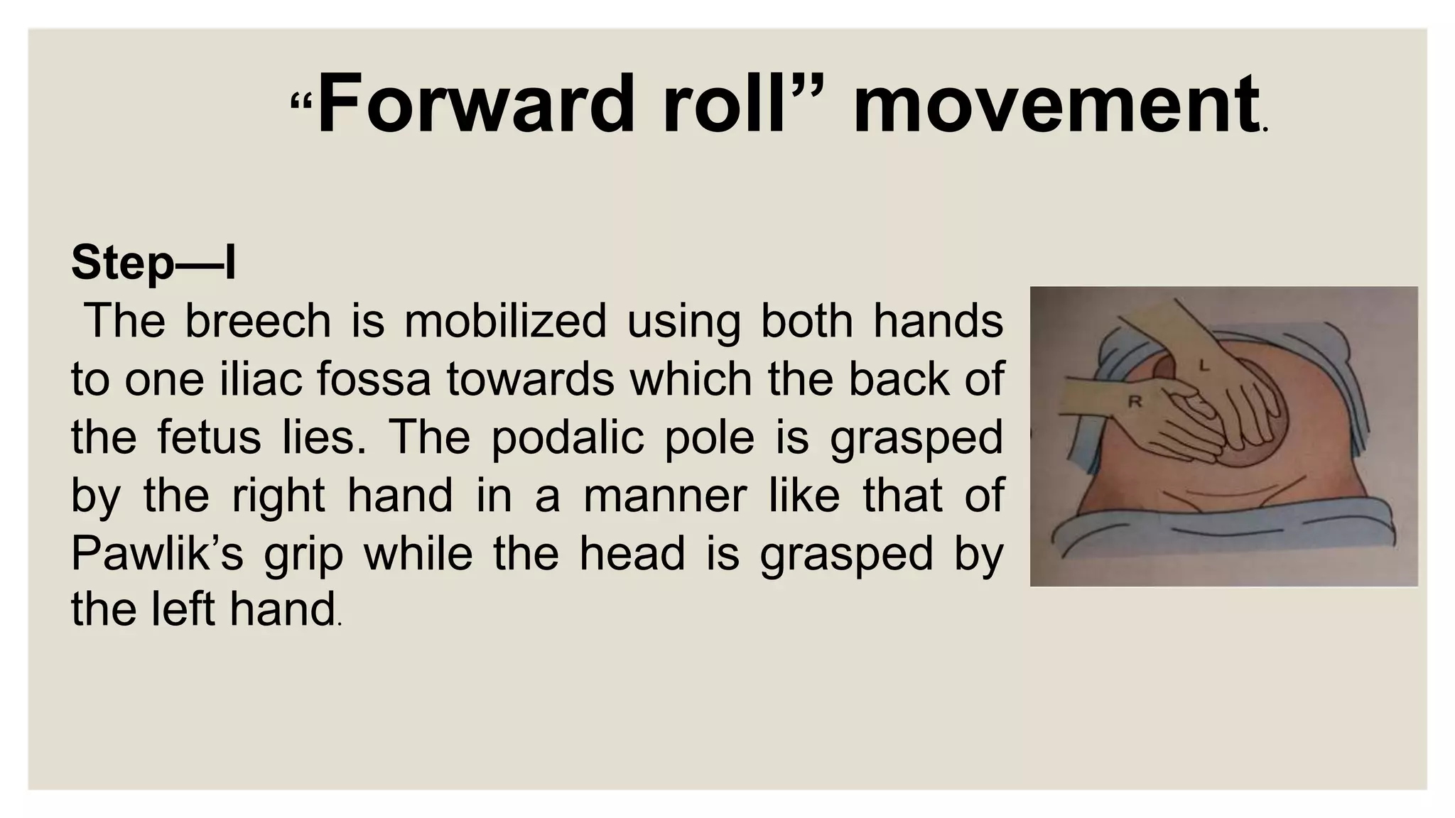 Unstable lie | PPTX | Pregnancy | Reproductive Health