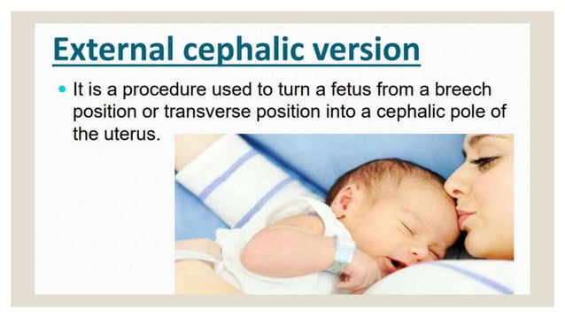 Unstable lie | PPTX | Pregnancy | Reproductive Health