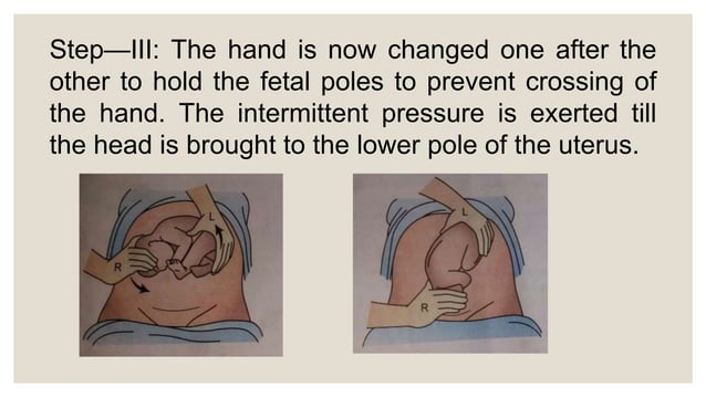 Unstable lie | PPTX | Pregnancy | Reproductive Health