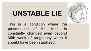 Unstable lie | PPT