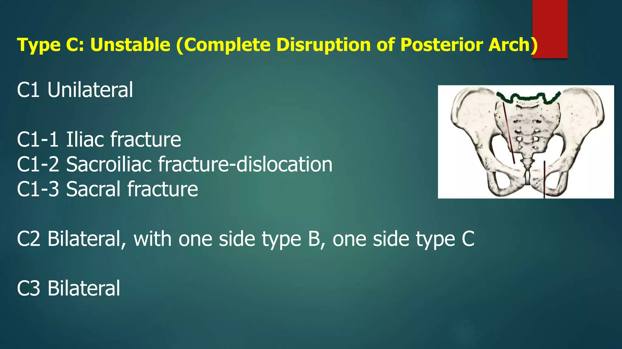 Unstable Pelvic Fracture Presentation | PPTX