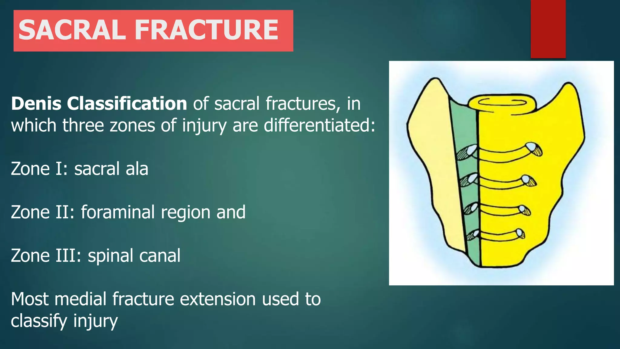 Unstable Pelvic Fracture Presentation | PPTX