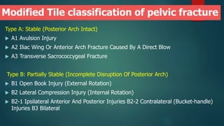 Unstable Pelvic Fracture Presentation | PPTX