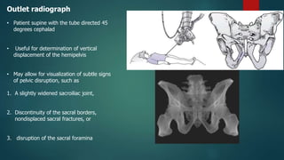 Unstable Pelvic Fracture Presentation | PPTX