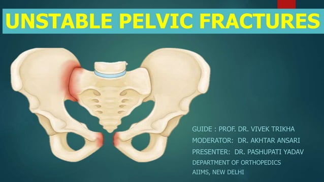 Unstable Pelvic Fracture Presentation | PPT