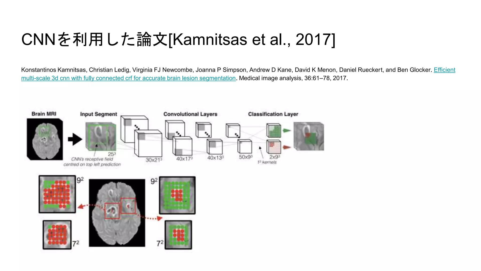 Unsupervised Detection Of Lesions In Brain Mri Using Constrained