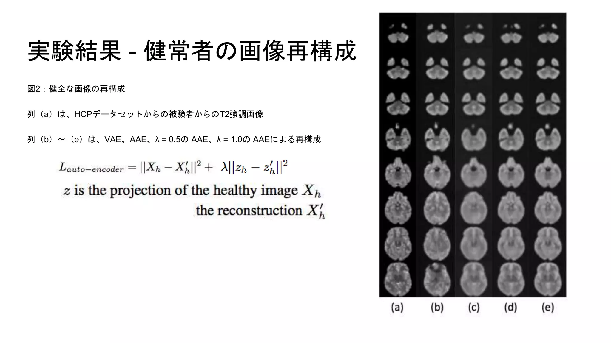 Unsupervised Detection Of Lesions In Brain Mri Using Constrained