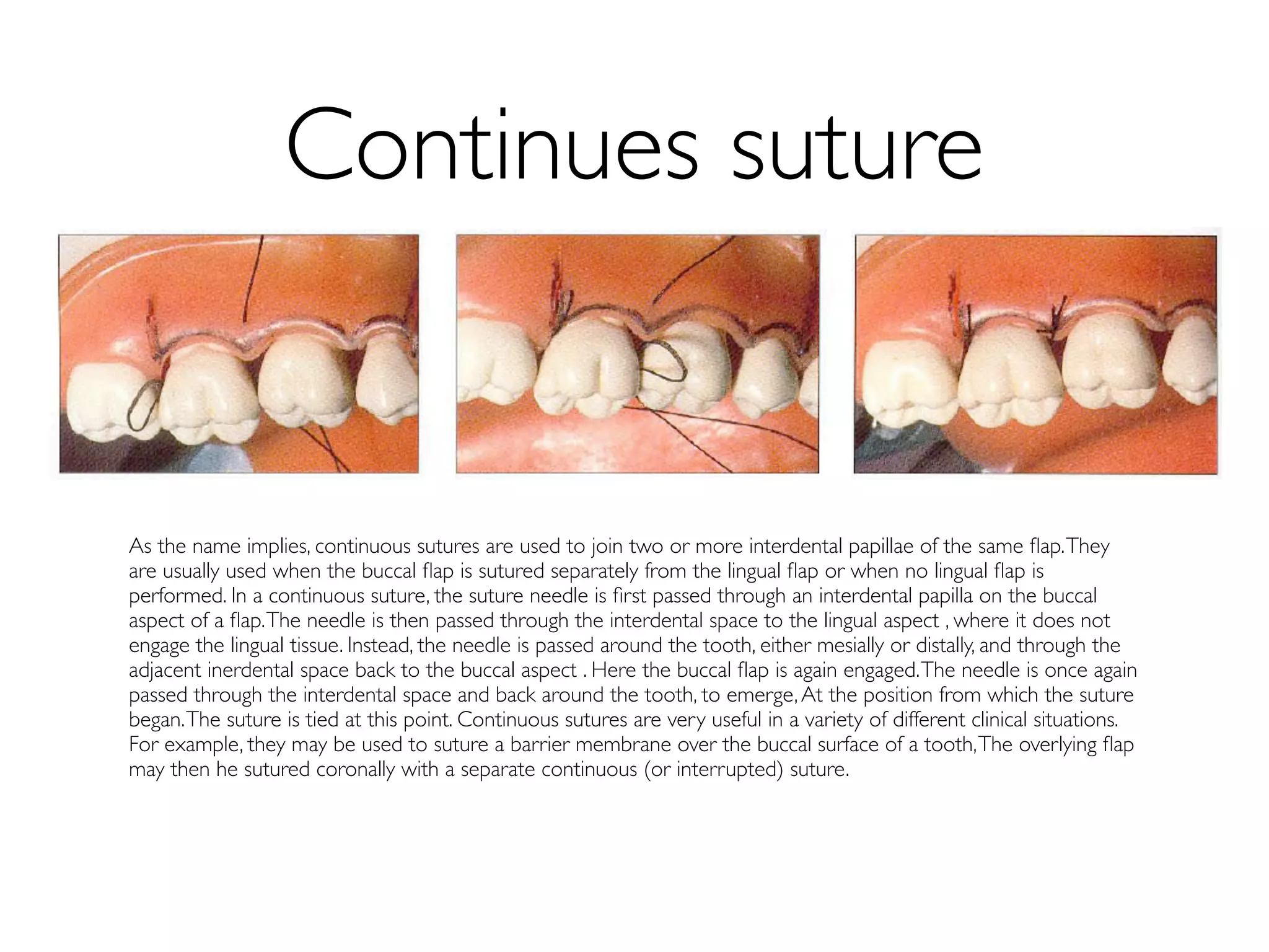 Periodontal instruments, surgery | PDF
