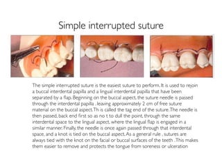 Periodontal instruments, surgery | PDF
