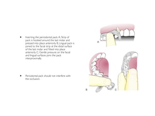 Periodontal instruments, surgery | PDF