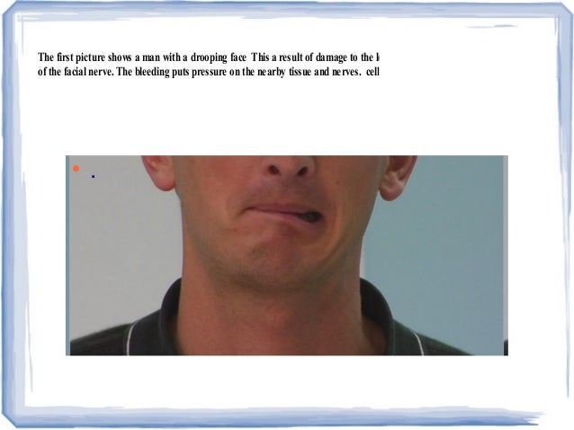 Untitled 1 [www.slideshare.net]