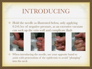 Breakdown of One-Handed IJ | KEY